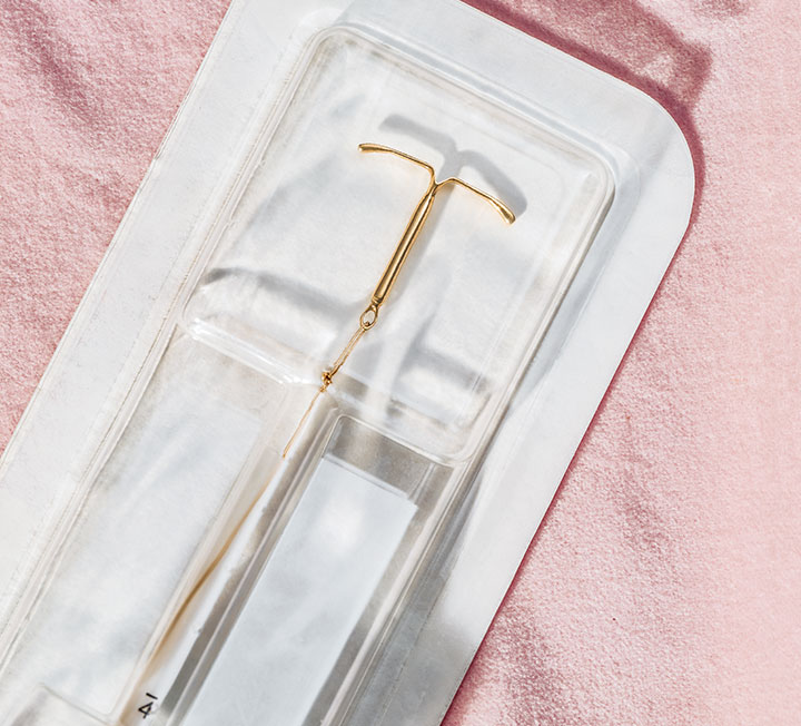 IUD 시술 진짜 괜찮을까?